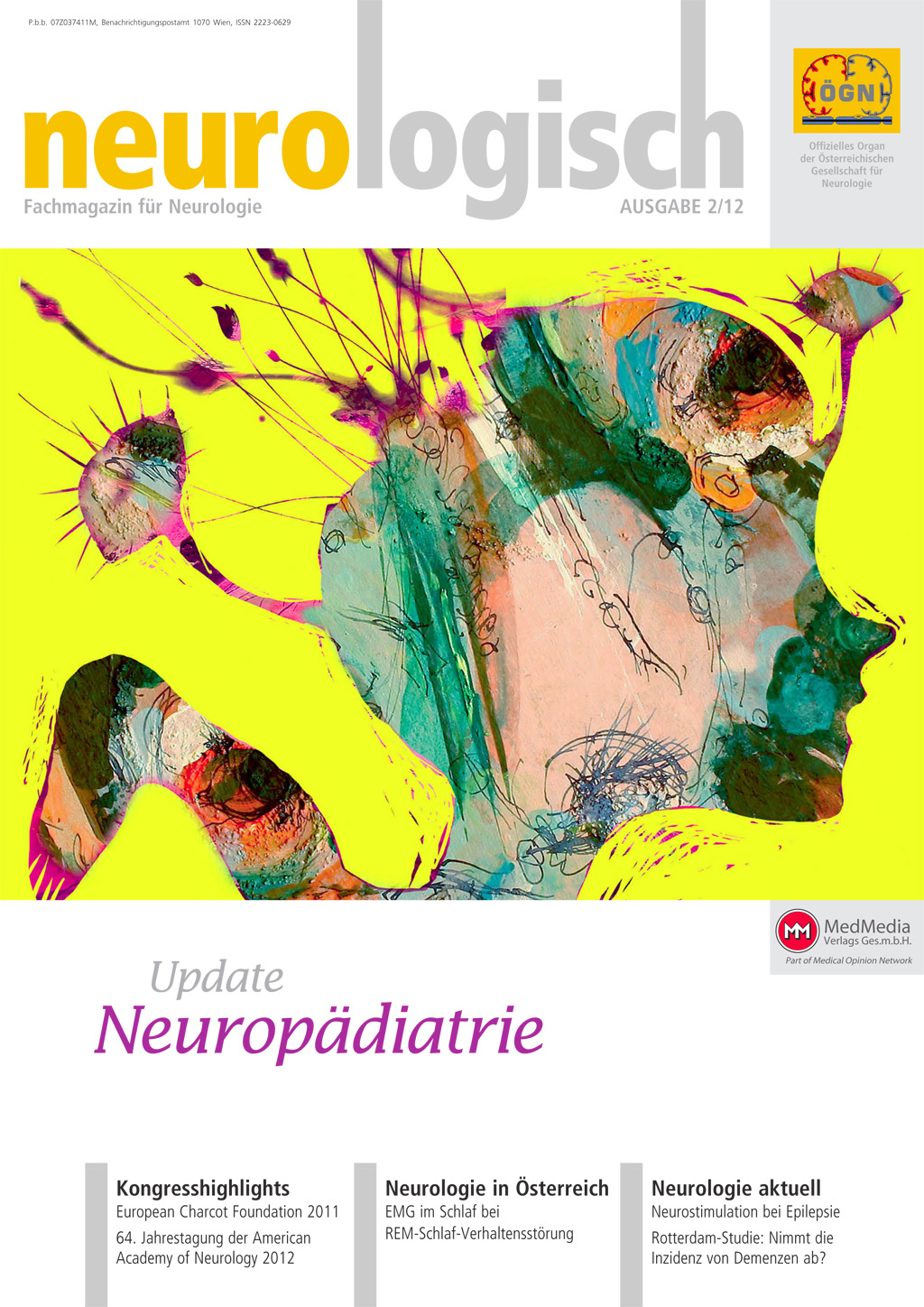 Update on T-LOC (transient loss of conciousness) | MedMedia