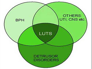 Neue LUTS-Guidelines | SPECTRUM Urologie