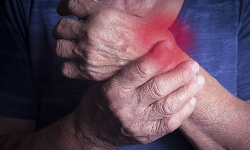 Therapie bei chronischer Polyarthritis | nextdoc