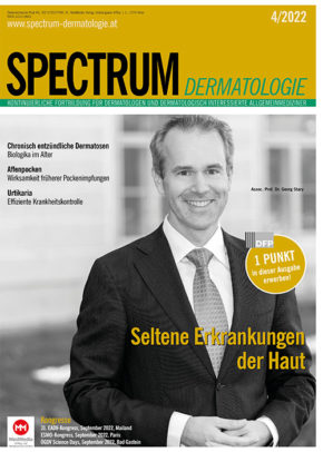 Mechanism of chronic inflammation in psoriasis-like skin and joint ...