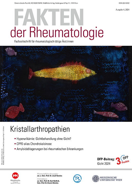 Update on T-LOC (transient loss of conciousness) | neurologisch